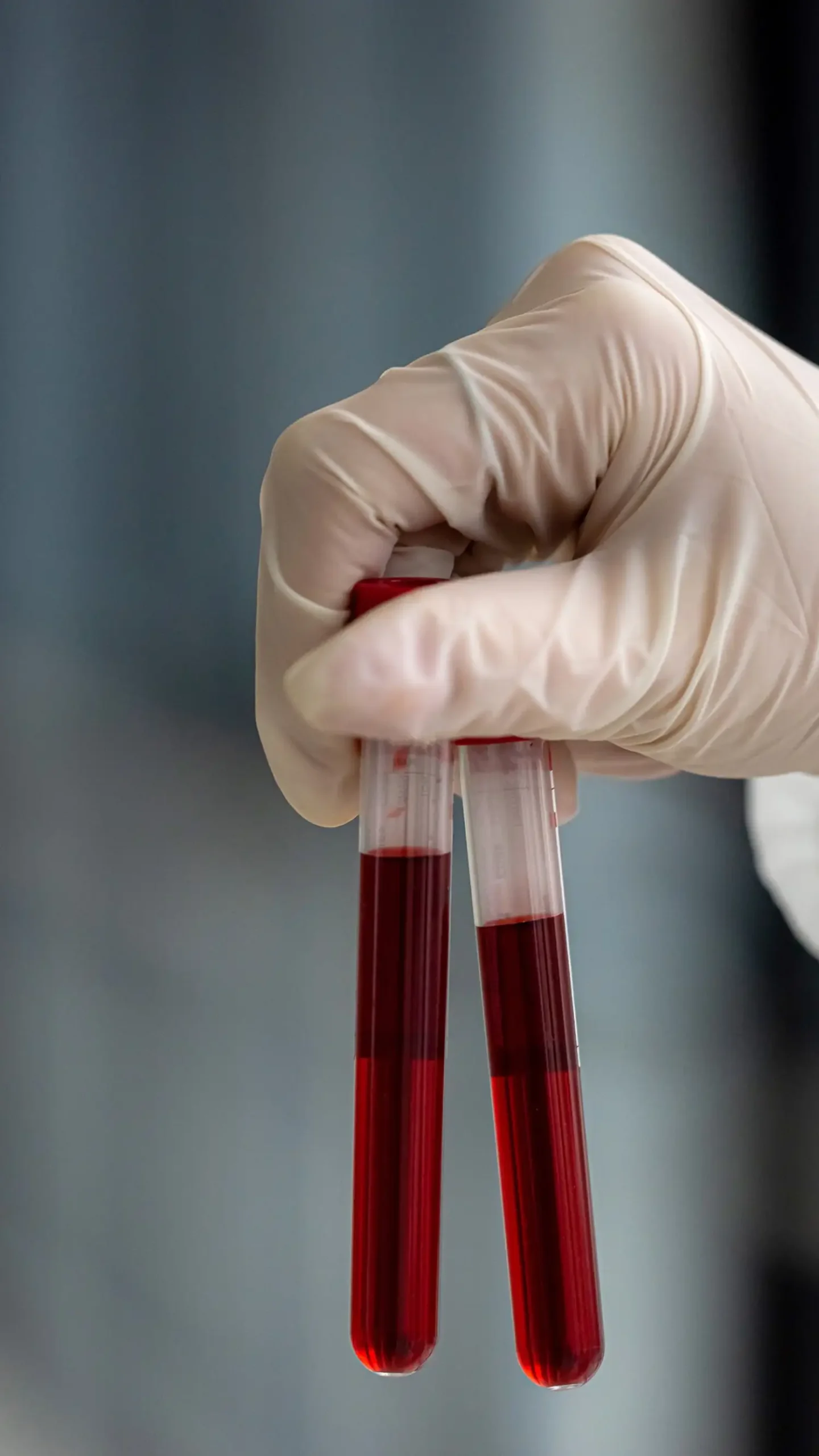 Healthy Living Tips - Meae Care