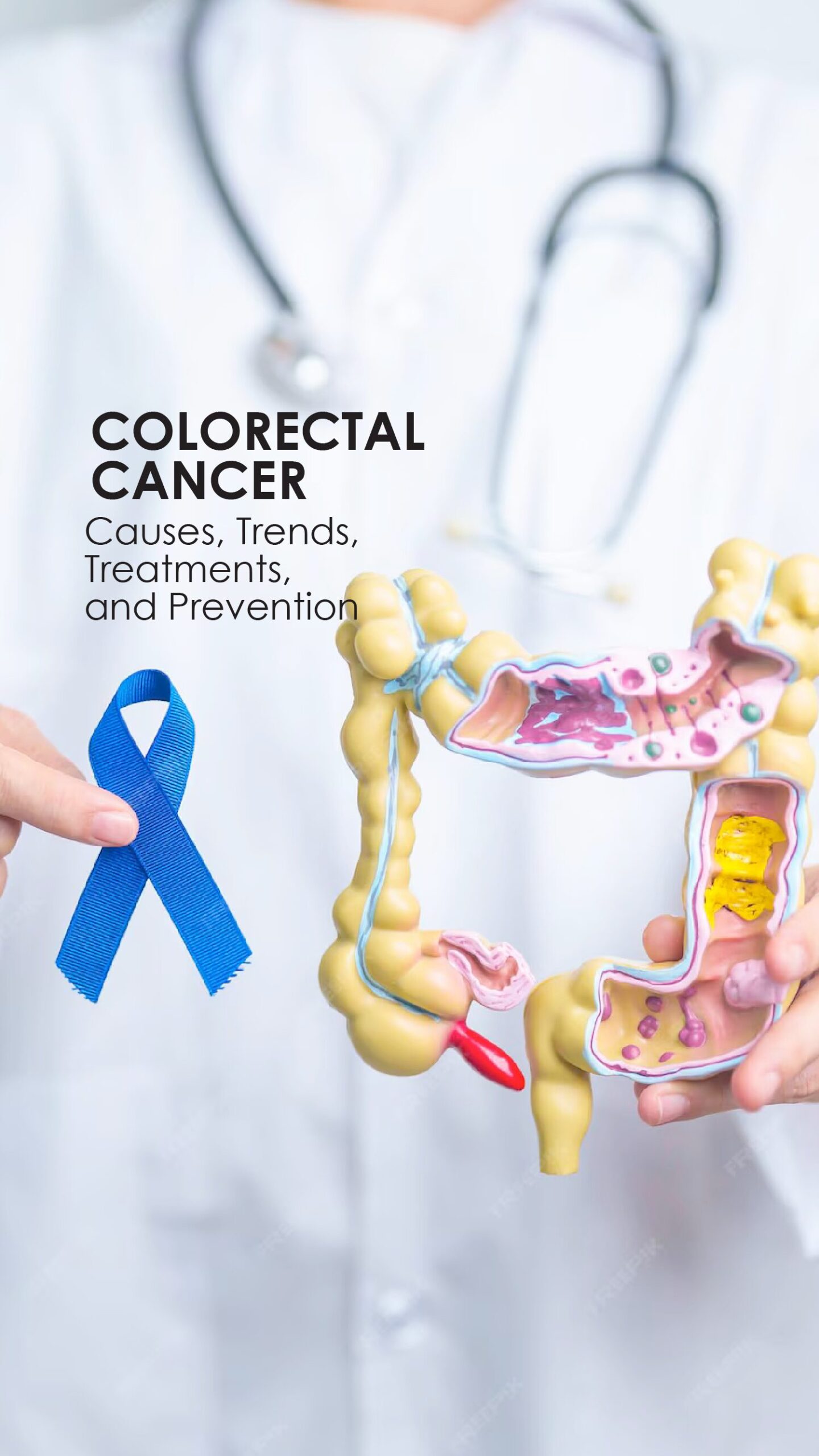 Colorectal Cancer | Causes, Trends, Treatments, and Prevention - Meae Care